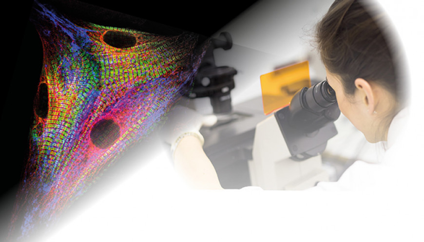 Secondary Antibodies - Jackson ImmunoResearch