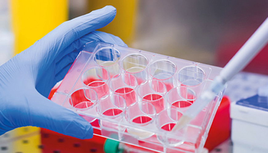 Secondary Antibodies - Jackson ImmunoResearch