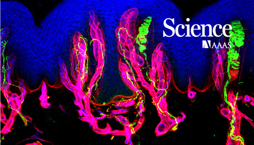 Secondary Antibodies - Jackson ImmunoResearch