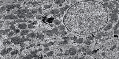 Secondary Antibody Conjugate Selection - Jackson Immuno