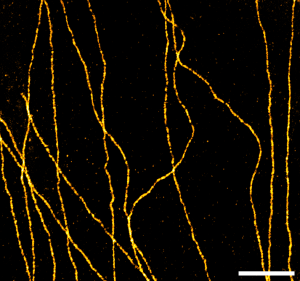 Super-Resolution Microscopy: Principles, Technologies, and ...