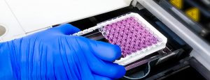 Assay Setup: Sandwich ELISA for Allergy