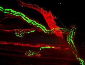Mouse foot axons and neuromuscular junctions